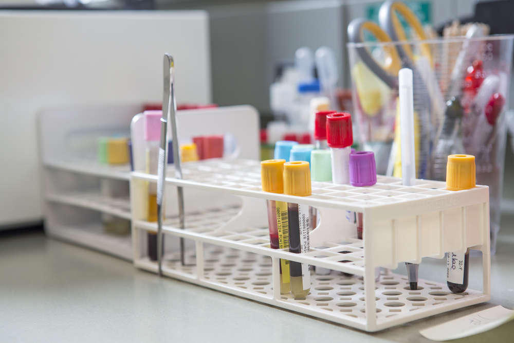 Laboratory Services | Pullman Regional Hospital